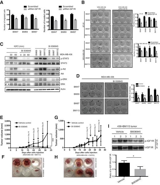 Metastatic Breast Carcinoma–Associated Fibroblasts Have Enhanced ...