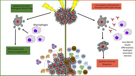 Triple Therapy with MerTK and PD1 Inhibition Plus Radiotherapy Promotes ...