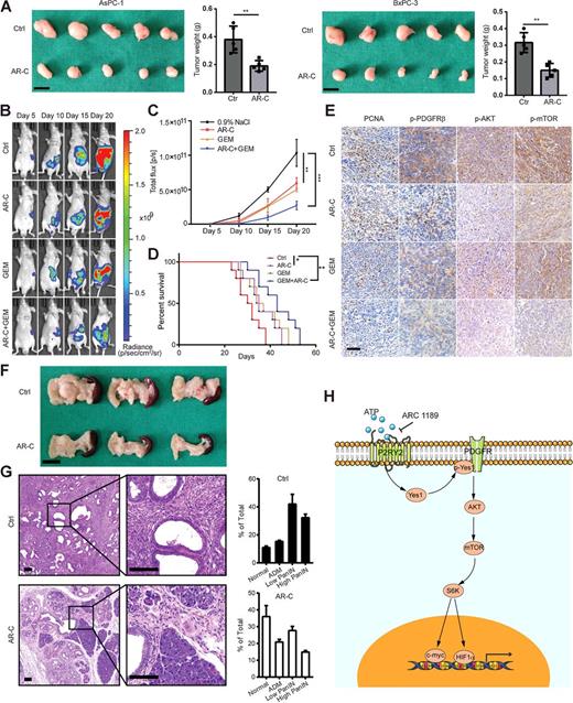 Targeting Purinergic Receptor P2Y2 Prevents the Growth of Pancreatic ...