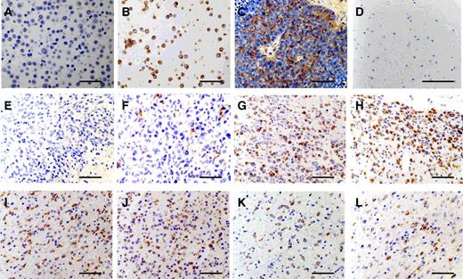 Cell Surface Notch Ligand DLL3 is a Therapeutic Target in Isocitrate ...