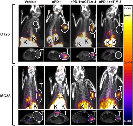 The Effectiveness of Checkpoint Inhibitor Combinations and ...