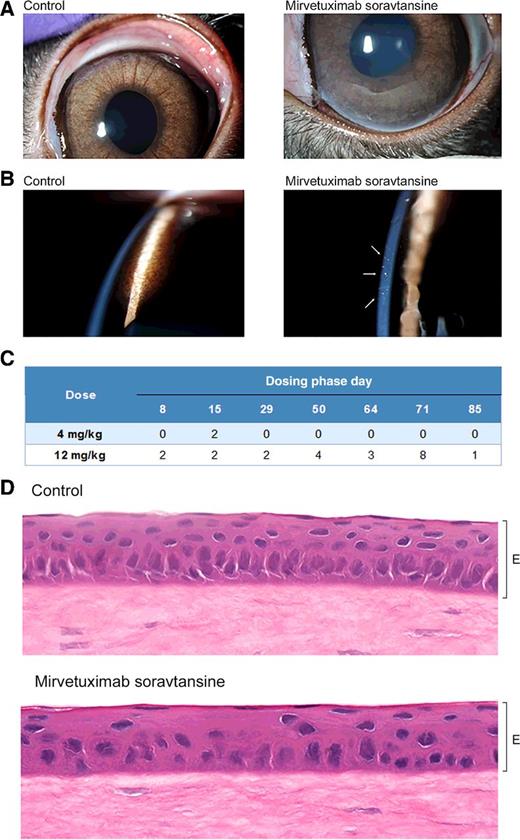 Evaluation of Prophylactic Corticosteroid Eye Drop Use in the ...