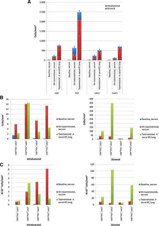 Immunologic Correlates of the Abscopal Effect in a SMARCB1/INI1 ...