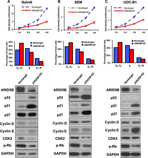 ARID5B Influences Antimetabolite Drug Sensitivity and Prognosis of ...