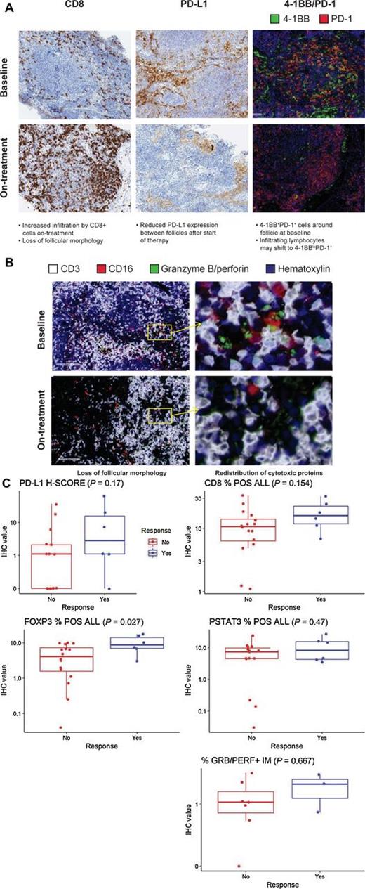 First-in-Human Study of Utomilumab, a 4-1BB/CD137 Agonist, in ...