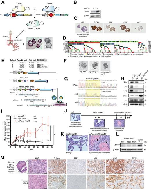 Generation of Genetically Engineered Mouse Lung Organoid Models for ...