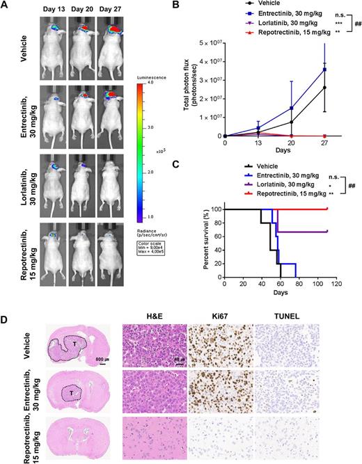 Repotrectinib Exhibits Potent Antitumor Activity in Treatment-Naïve and ...