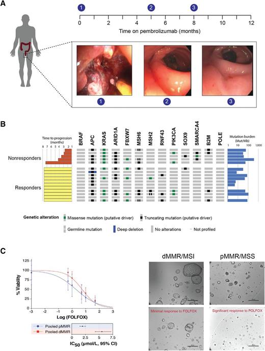 Mismatch Repair–Deficient Rectal Cancer and Resistance to Neoadjuvant ...