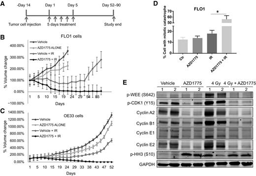 Wee1 Kinase Inhibitor AZD1775 Effectively Sensitizes Esophageal Cancer ...