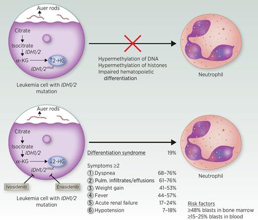 Differentiating the Differentiation Syndrome Associated with IDH ...