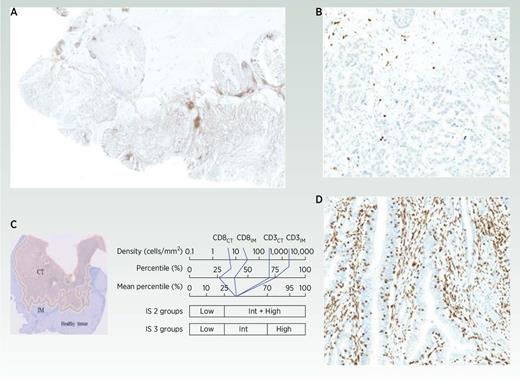 The Immunoscore: Colon Cancer and Beyond | Clinical Cancer Research ...