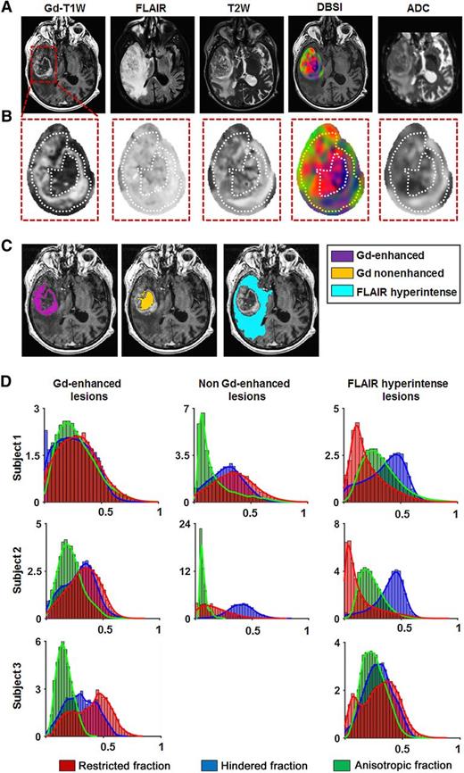 Diffusion Histology Imaging Combining Diffusion Basis Spectrum Imaging ...