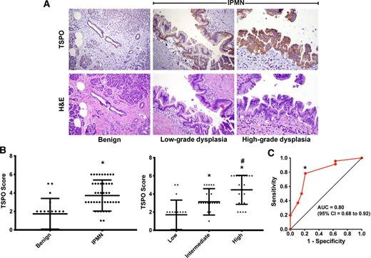 TSPO-targeted PET and Optical Probes for the Detection and Localization ...