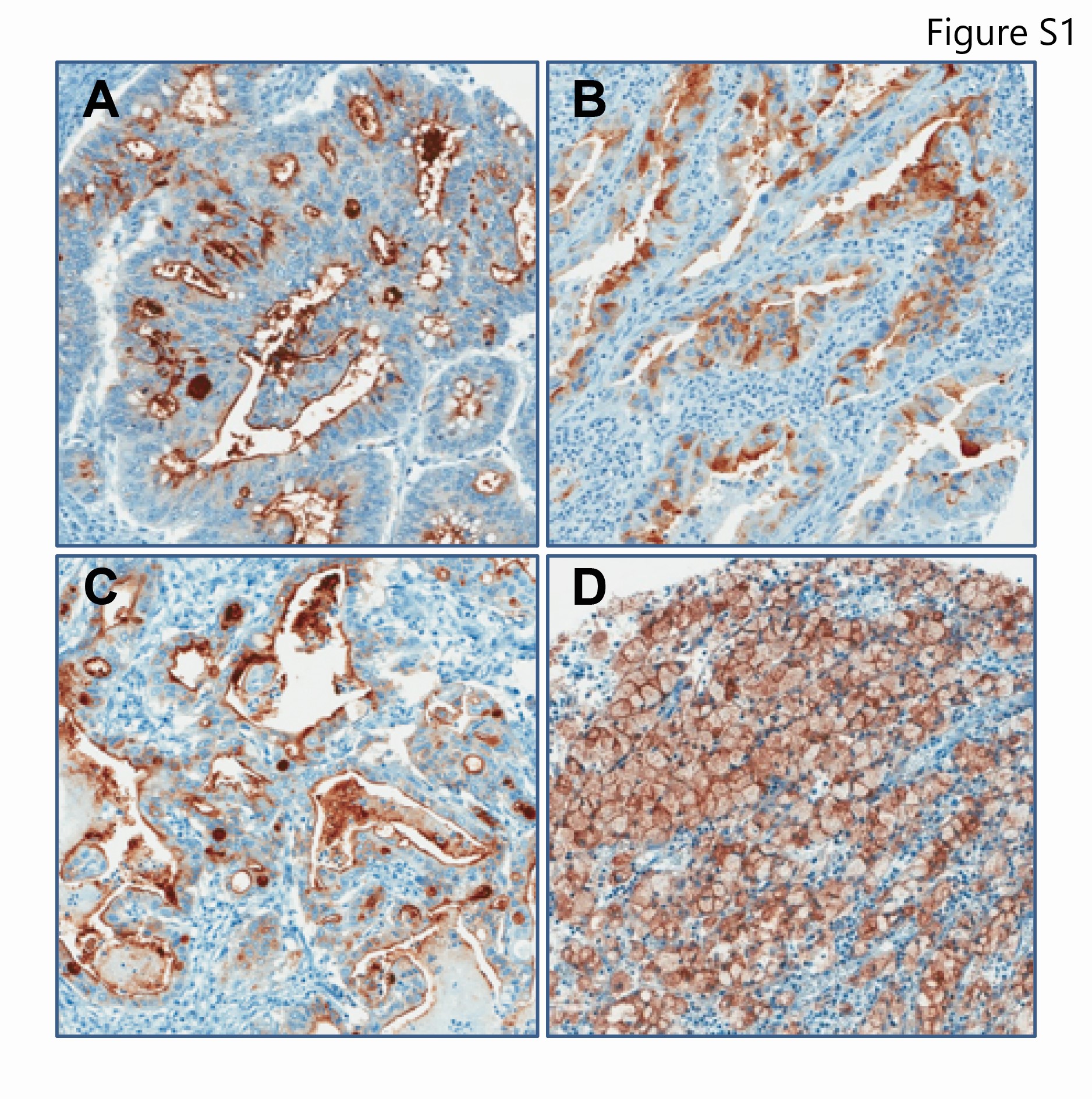 Preclinical Activity of SAR408701: A Novel Anti-CEACAM5–maytansinoid Antibody–drug Conjugate for ...