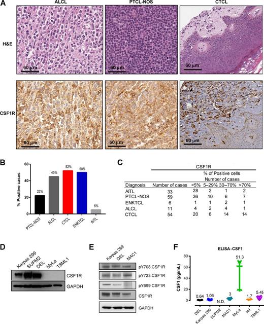 Colony-Stimulating Factor 1 Receptor (CSF1R) Activates AKT/mTOR ...