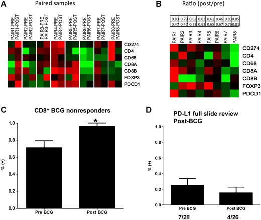 Adaptive Immune Resistance to Intravesical BCG in Non–Muscle Invasive ...