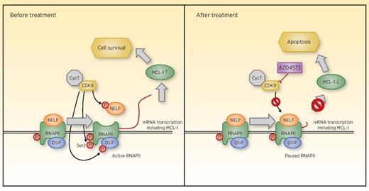 A New CDK9 Inhibitor on the Block to Treat Hematologic Malignancies ...