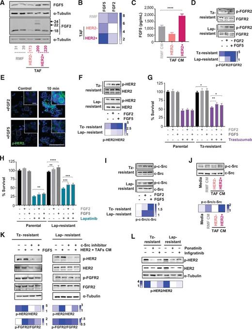 Tumor-Associated Fibroblasts Promote HER2-Targeted Therapy Resistance ...