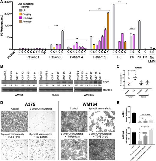 Proteomic Analysis of CSF from Patients with Leptomeningeal Melanoma ...