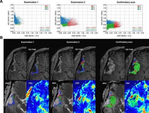 Spatiotemporal Heterogeneity in Multiparametric Physiologic MRI Is ...