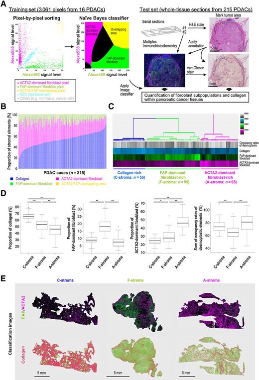 Three Distinct Stroma Types in Human Pancreatic Cancer Identified by ...