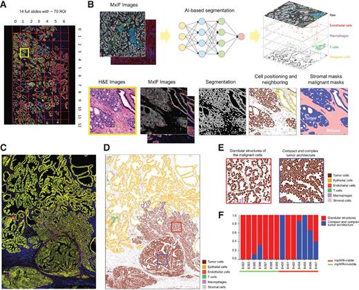 Single-cell Spatial Proteomic Revelations on the Multiparametric MRI ...
