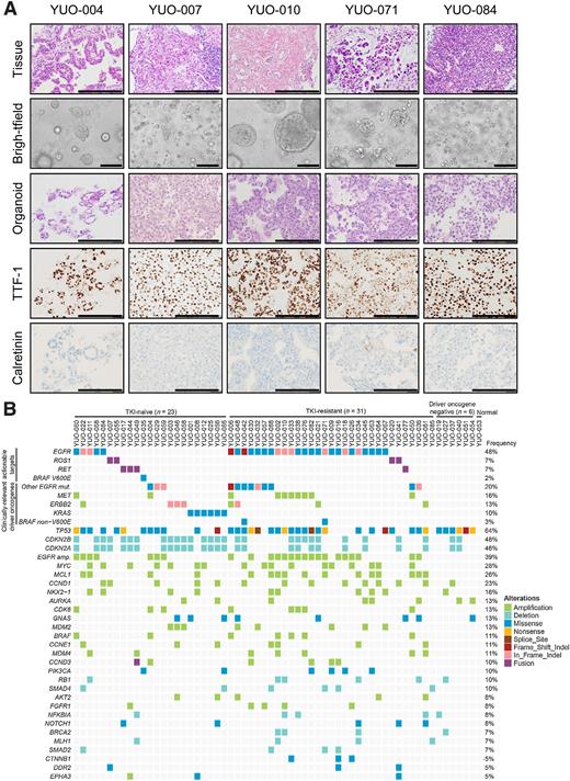 Modeling Clinical Responses to Targeted Therapies by Patient-Derived ...