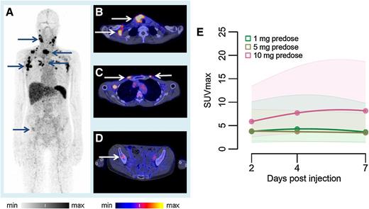 First-in-Human Study of the Biodistribution and Pharmacokinetics of ...