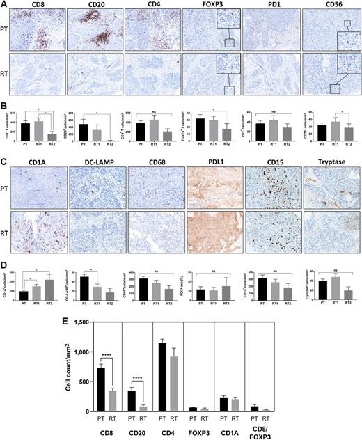 Recurrent HNSCC Harbor an Immunosuppressive Tumor Immune ...