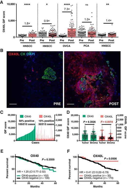 Spatial Mapping and Immunomodulatory Role of the OX40/OX40L Pathway in ...