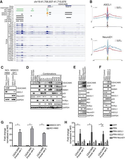 Regulation of CEACAM5 and Therapeutic Efficacy of an Anti-CEACAM5–SN38 ...