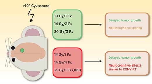 News FLASH-RT: To Treat GBM and Spare Cognition, Fraction Size and ...