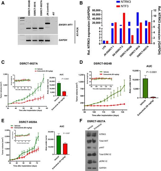 Therapeutic Potential of NTRK3 Inhibition in Desmoplastic Small Round ...