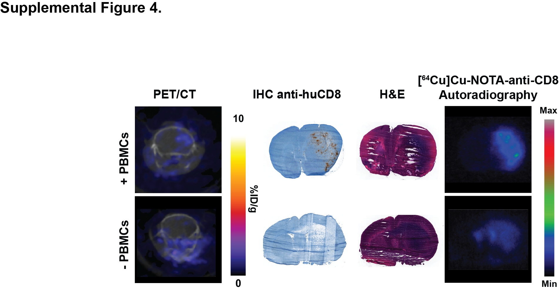Imaging Tumor-Infiltrating Lymphocytes in Brain Tumors with [64Cu]Cu ...