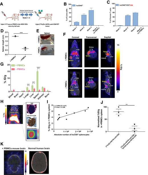 Imaging Tumor-Infiltrating Lymphocytes in Brain Tumors with [64Cu]Cu ...