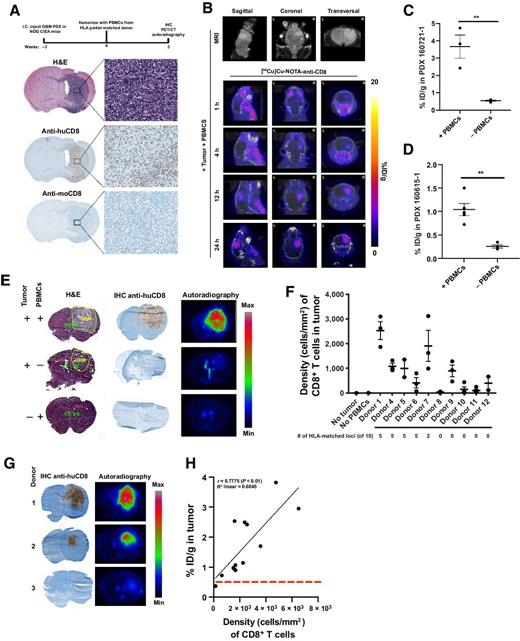 Imaging Tumor-Infiltrating Lymphocytes in Brain Tumors with [64Cu]Cu ...