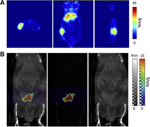 PSA-Targeted Alpha-, Beta-, and Positron-Emitting Immunotheranostics in ...