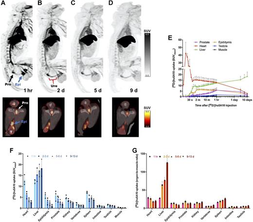 PSA-Targeted Alpha-, Beta-, and Positron-Emitting Immunotheranostics in ...