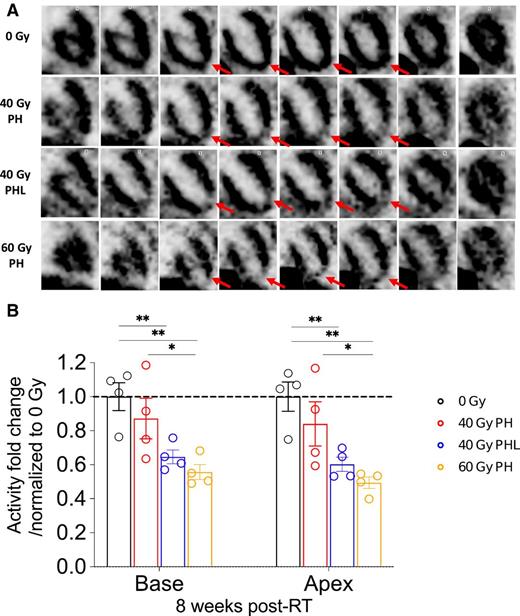A Novel Mouse Model of Radiation-Induced Cardiac Injury Reveals ...