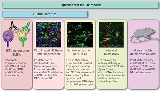 IL8, Neutrophils, and NETs in a Collusion against Cancer Immunity and ...