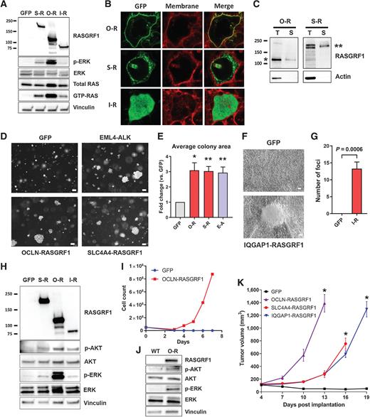 RASGRF1 Fusions Activate Oncogenic RAS Signaling and Confer Sensitivity ...