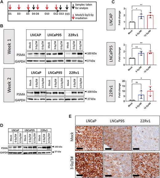 Prostate-Specific Membrane Antigen Expression and Response to DNA ...