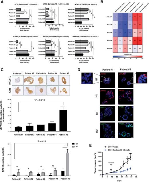 Targeting the DNA Damage Response Pathways and Replication Stress in ...