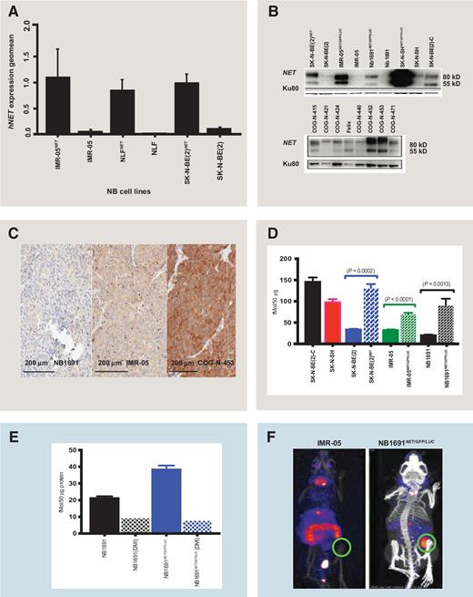 Preclinical Development of [211At]meta- astatobenzylguanidine ([211At ...