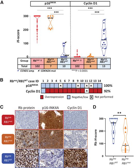 Rb Tumor Suppressor in Small Cell Lung Cancer: Combined Genomic and IHC ...