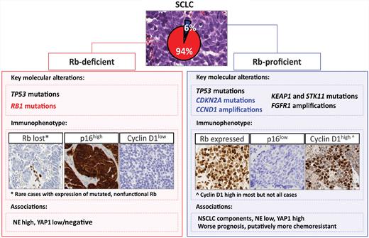 Rb Tumor Suppressor in Small Cell Lung Cancer: Combined Genomic and IHC ...