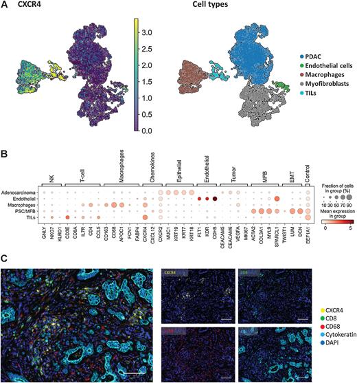Multi-omic Characterization of Pancreatic Ductal Adenocarcinoma Relates ...