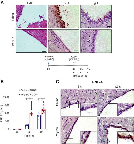 Safety and Efficacy of Intraventricular Immunovirotherapy with ...