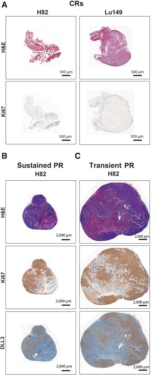 Radioimmunotherapy Targeting Delta-like Ligand 3 in Small Cell Lung ...