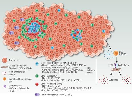 B Cells and Tertiary Lymphoid Structures: Friends or Foes in Cancer ...